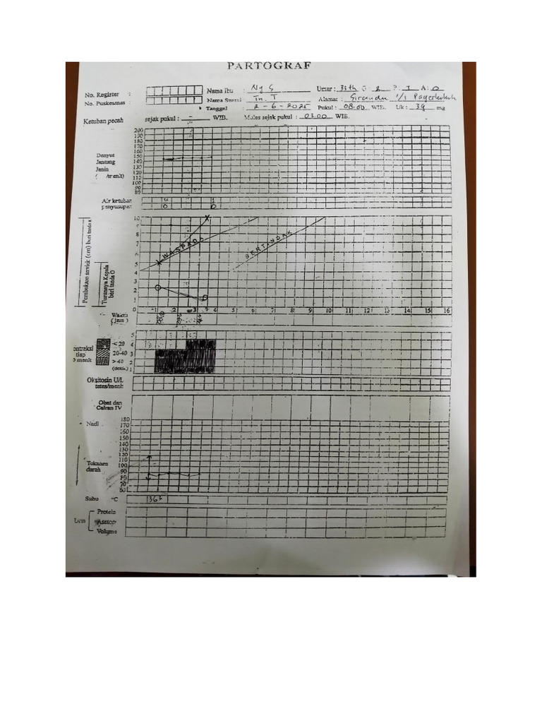 Partograf | PDF