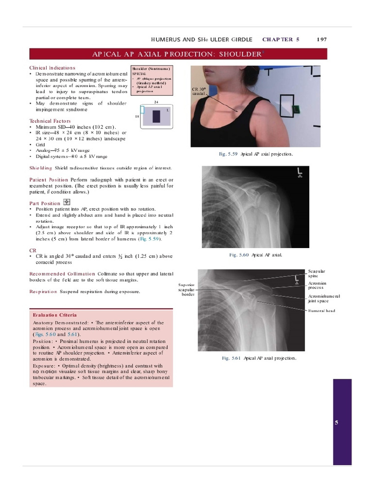 Shoulder Views | PDF