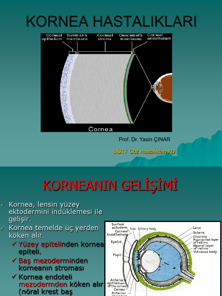 Kornea Hastalıkları | PDF