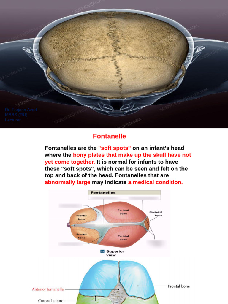 Understanding Infant Fontanelles and Sutures | PDF