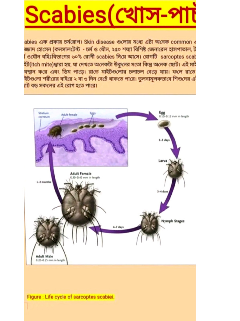 Scabies | PDF