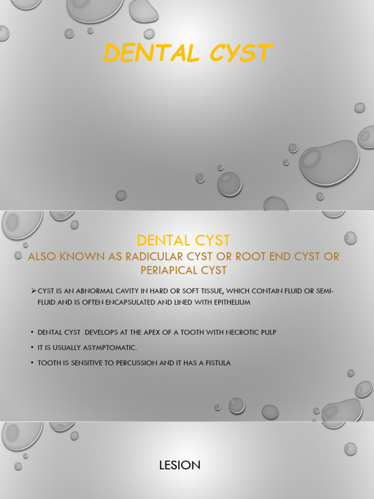Dental Cyst | PDF