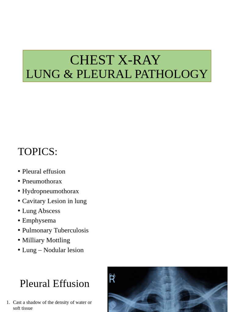 Chest X-Ray: Lung & Pleural Pathology | PDF | Lung | Respiratory System