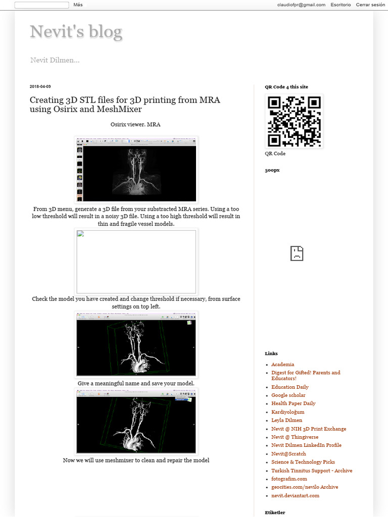 Nevit's Blog - Creating 3D STL Files For 3D Printing From MRA Using ...