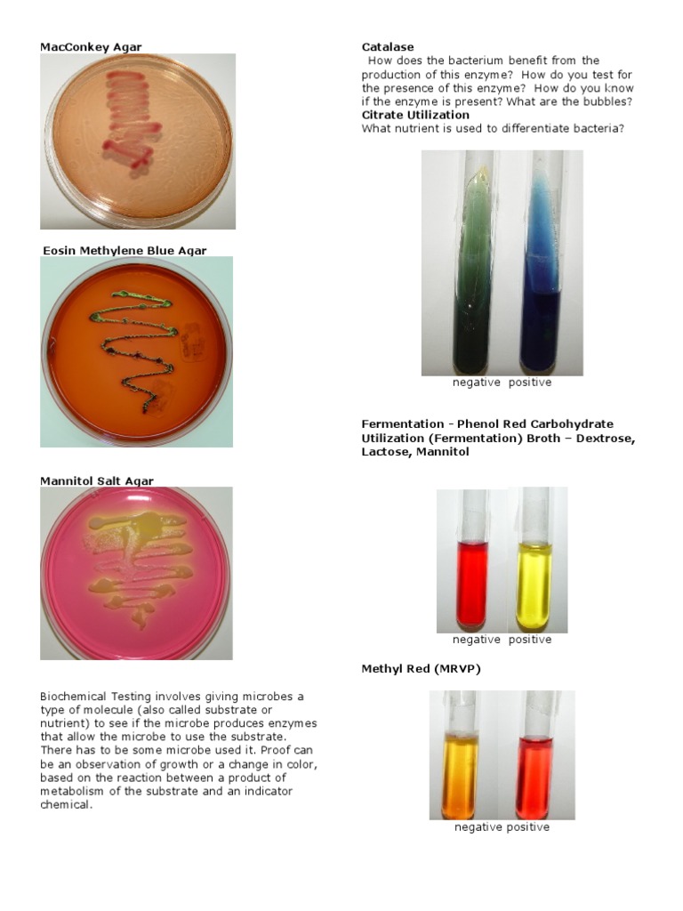 Macconkey Agar Lactose Fermentation