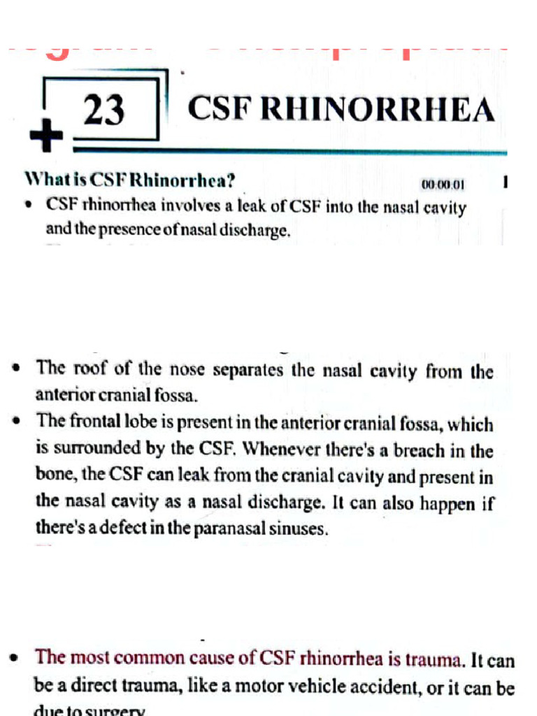 CSF Rhinorrhea | PDF