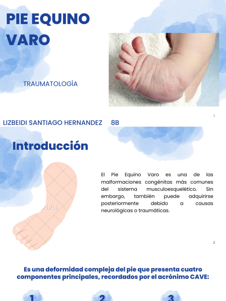 Pie Equino Varo: Causas y Tratamiento | PDF | Pie | Enfermedades y ...