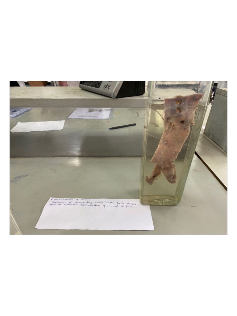 Pathology Specimen 2 | PDF