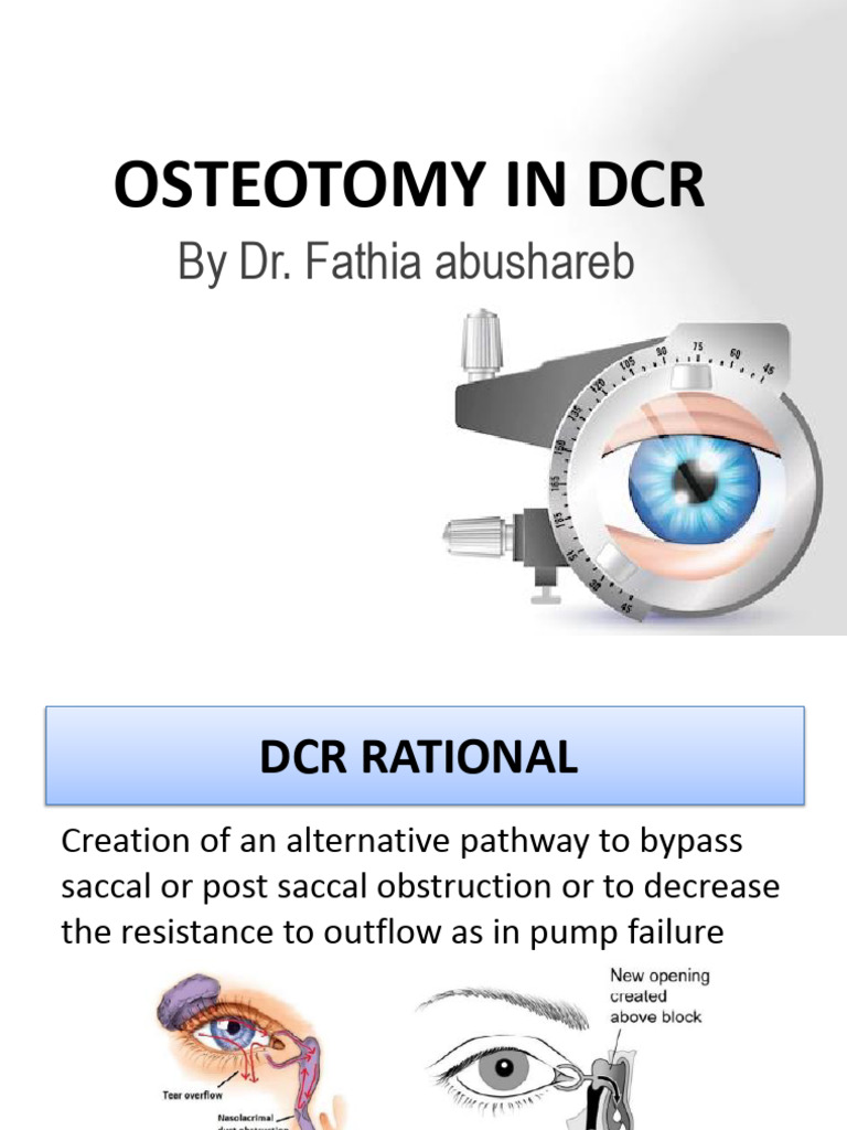 Osteotomy Techniques in DCR Surgery | PDF