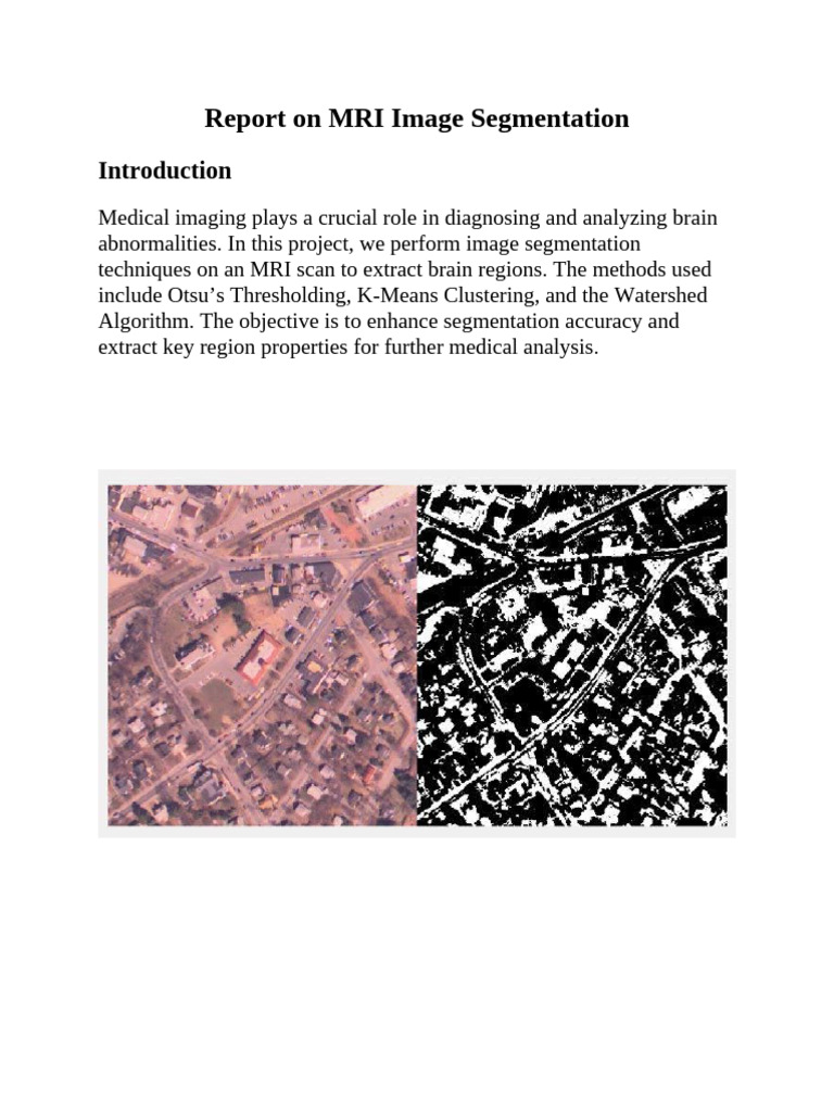 Report On MRI Image Segmentation | PDF | Image Segmentation | Cluster Analysis