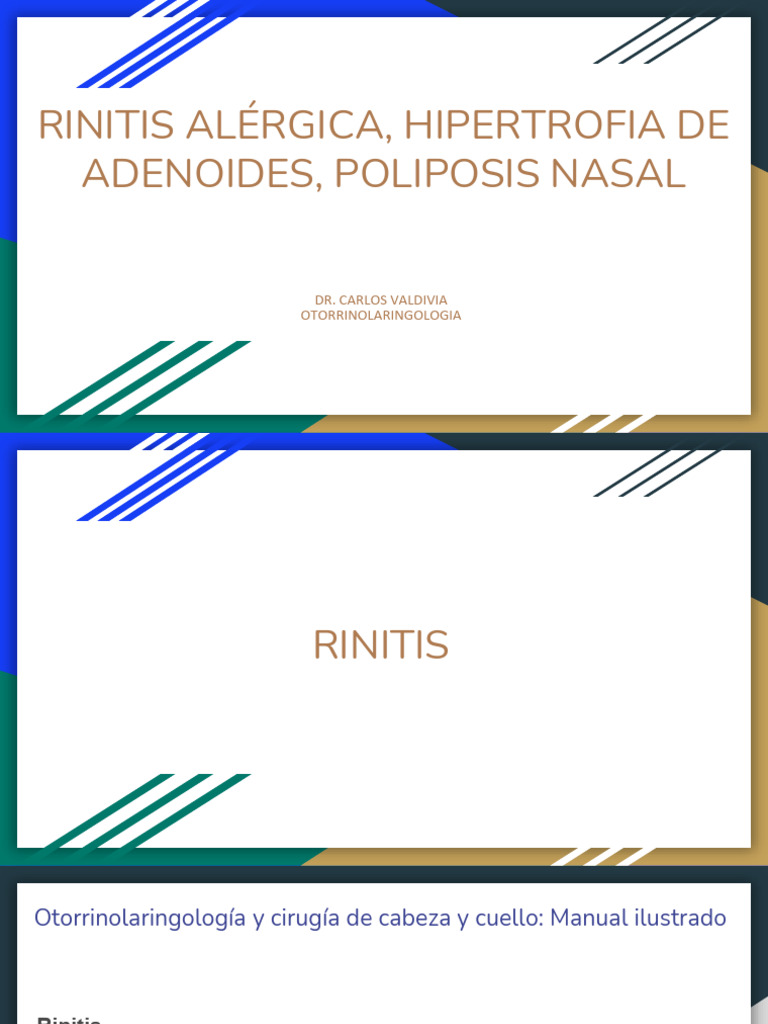 Rinitis Alergica , Hipertrofia de Adenoides, Poliposis Nasal Dr Valdivia | PDF | Alergia ...