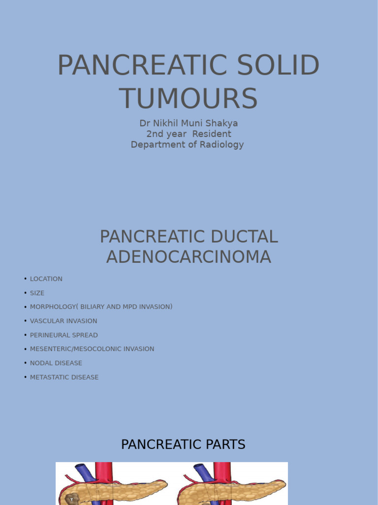 Pancreatic Tumors: Imaging & Staging Guide | PDF | Pancreas ...
