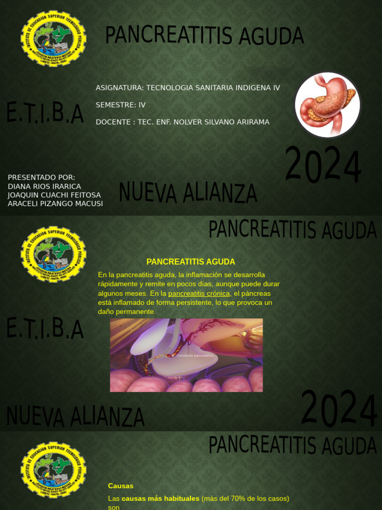Pancreatitis Aguda | PDF