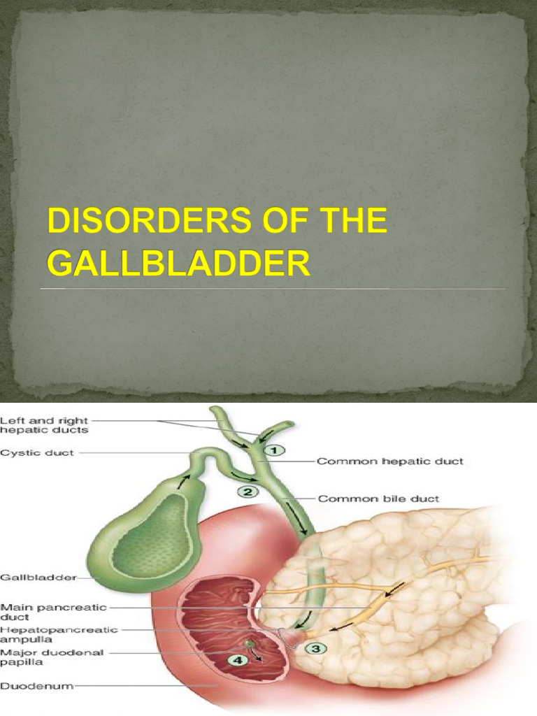 Gallbladder Disorders: Cholecystitis & Stones | PDF | Gallbladder | Bile