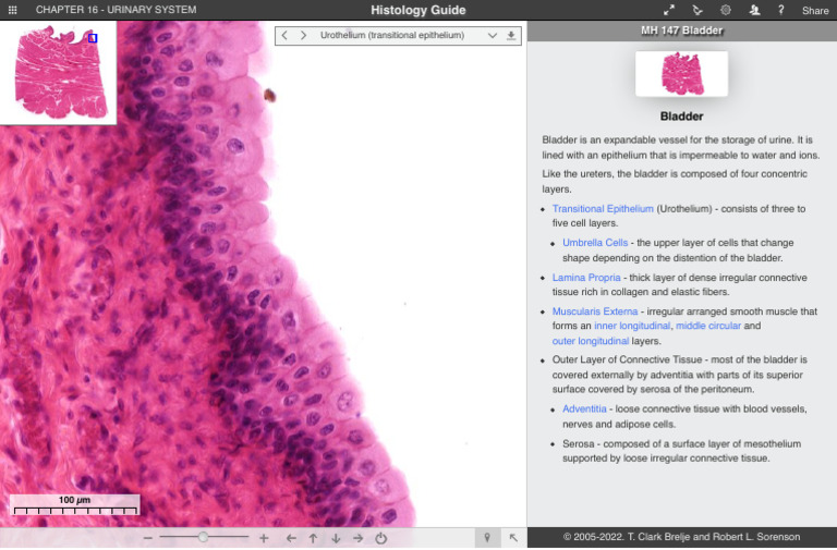 Urinary Bladder Histology Overview | PDF | Tissue (Biology ...