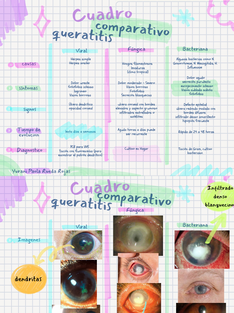 Tipos de queratitis: diagnóstico y síntomas | PDF | Enfermedades y ...