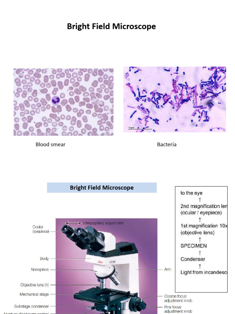 Bright vs Dark Field Microscope Insights | PDF