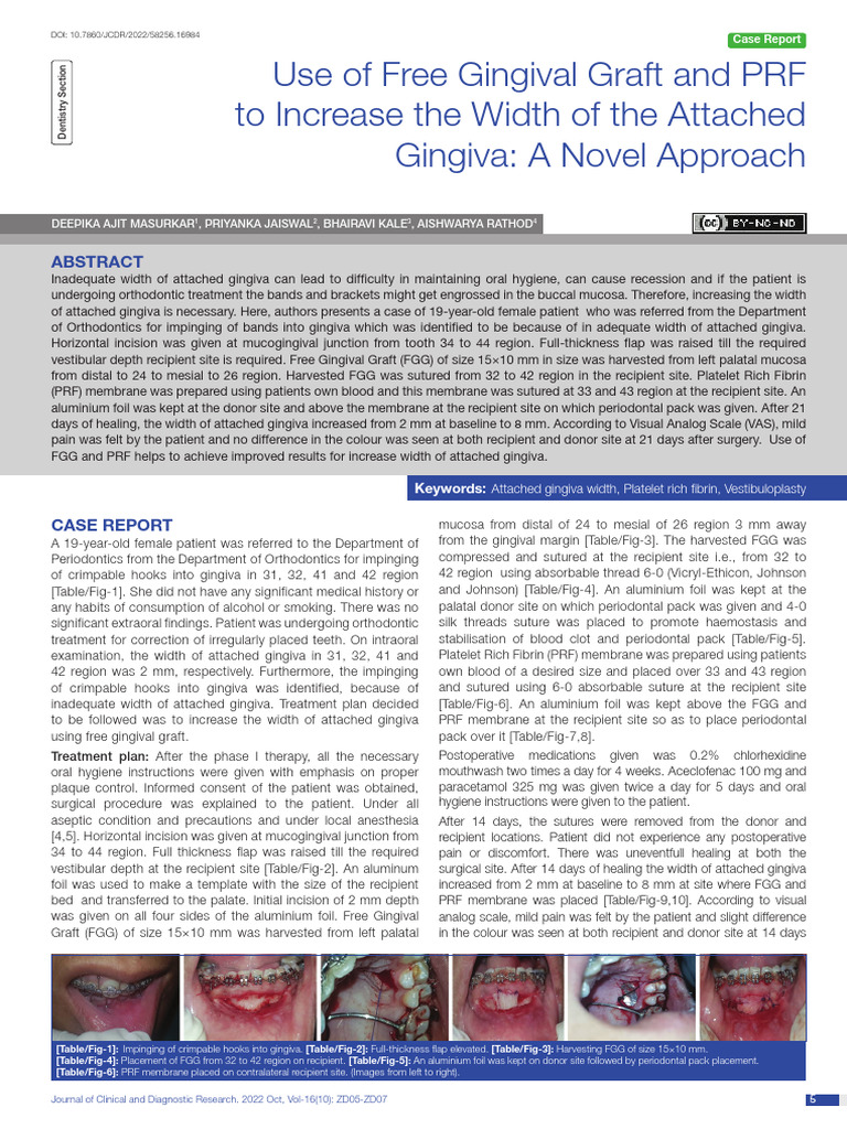 Free Gingival Graft and PRF for Gingiva Width | PDF | Periodontology ...