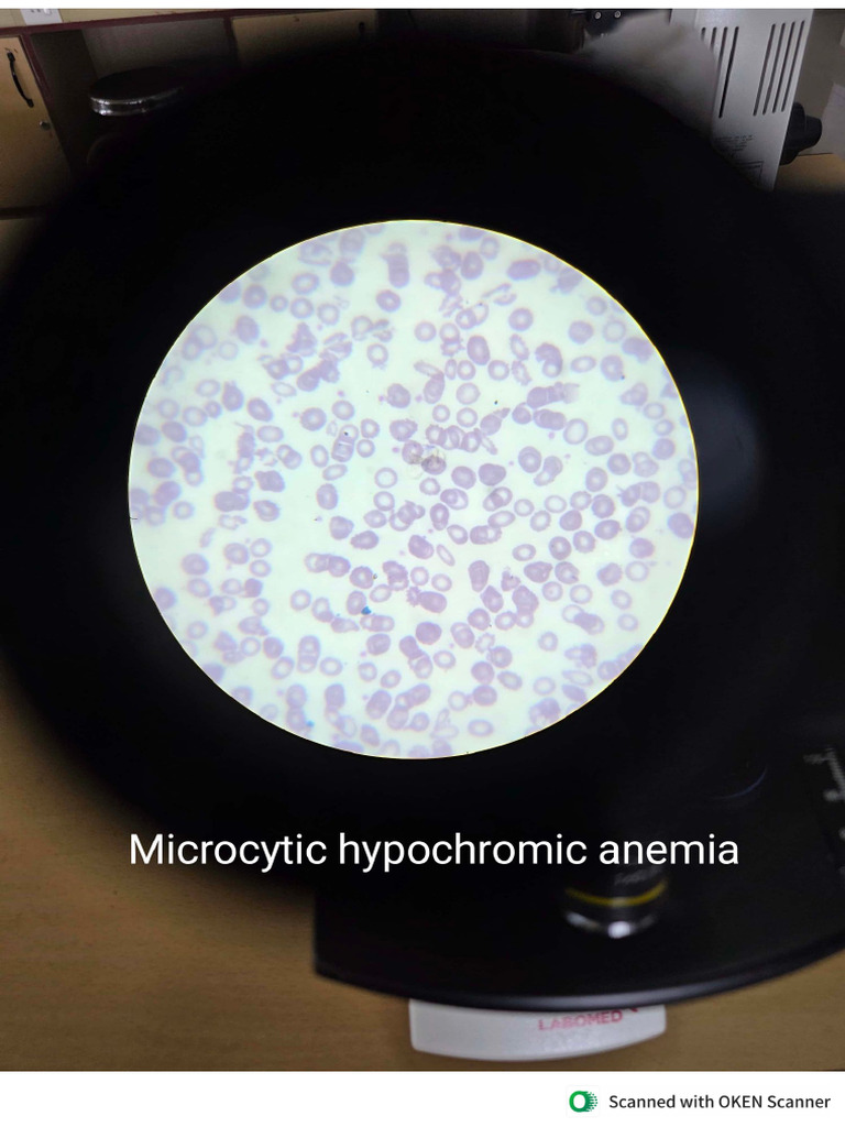 Haematology Slides 2025 | PDF