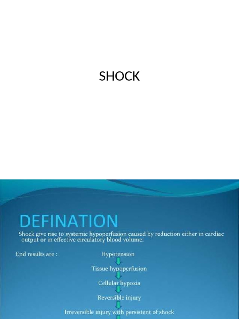 Shock PPT.X | PDF