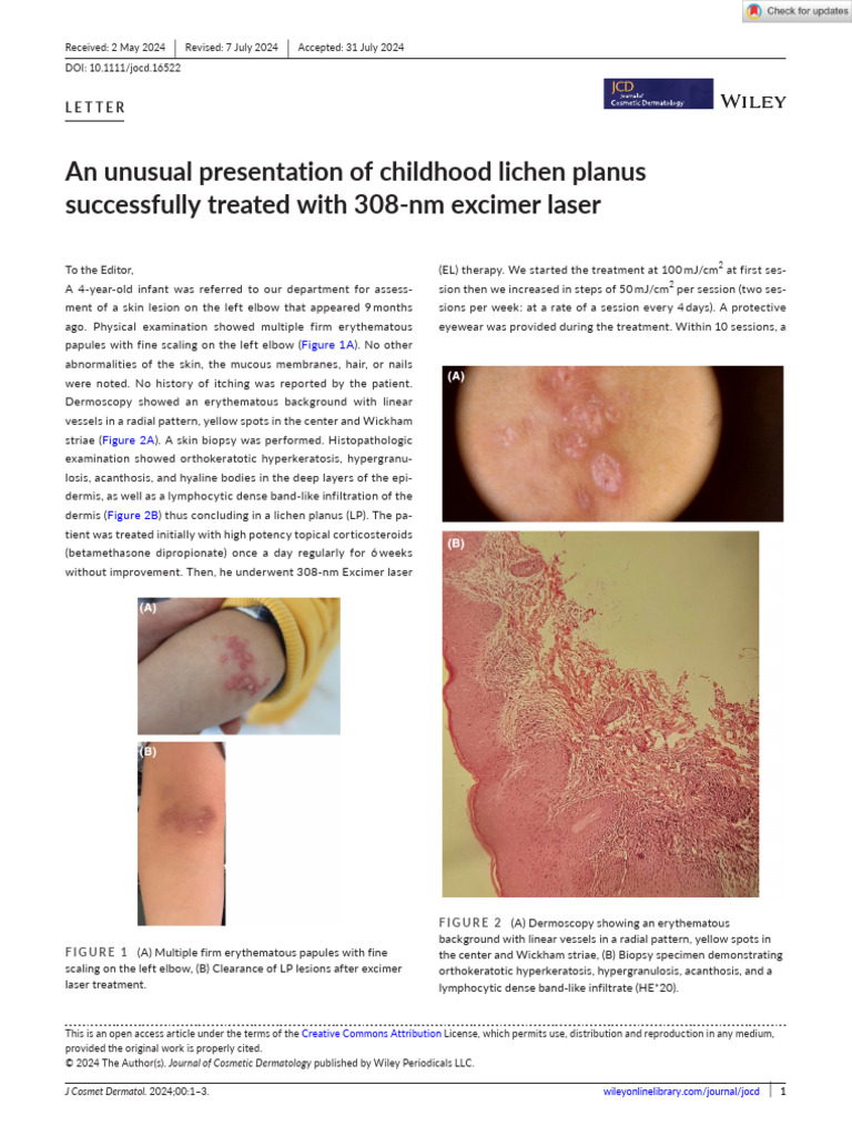 J of Cosmetic Dermatology - 2024 - Mzoughi - An Unusual Presentation of ...