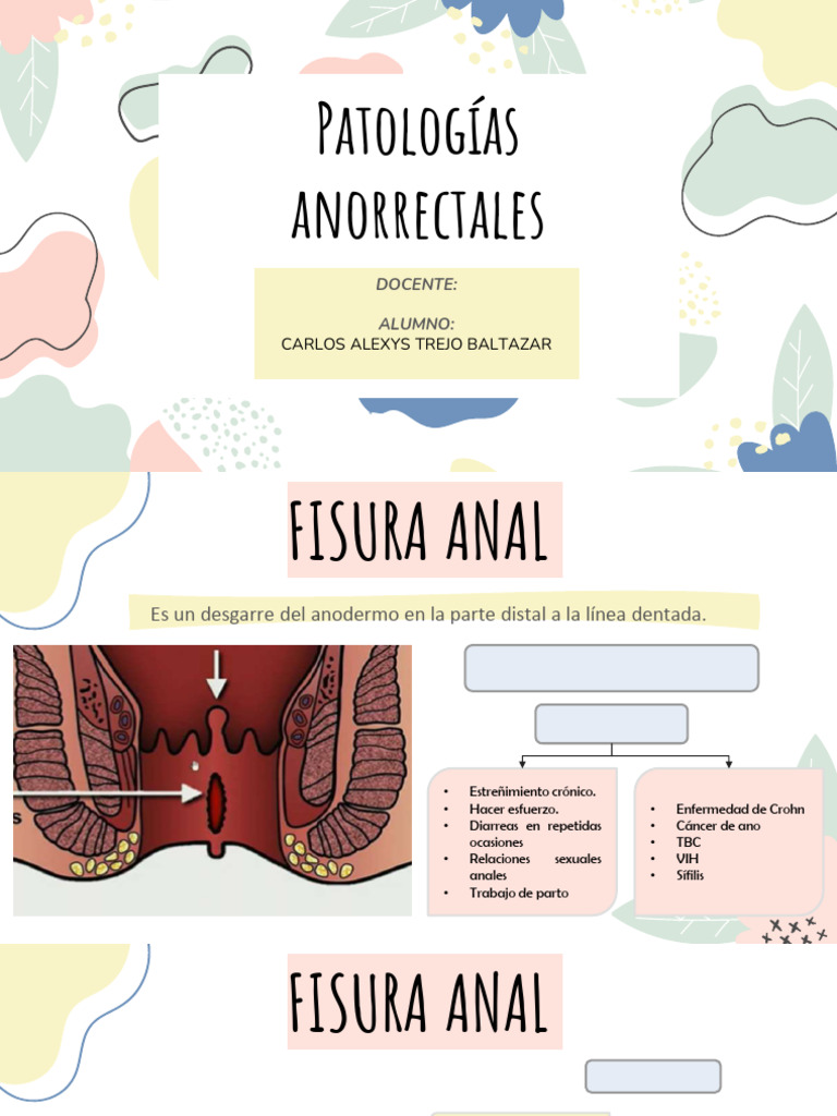 Patologías Anorrectales y Tratamientos | PDF | Hemorroides ...