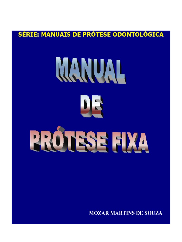 Manual de+Prótese+Fixa | PDF | Fundição (metalurgia) | Prótese