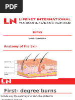 Wallace Rule of Nines for Burn Assessment | PDF | Burn | Intravenous ...