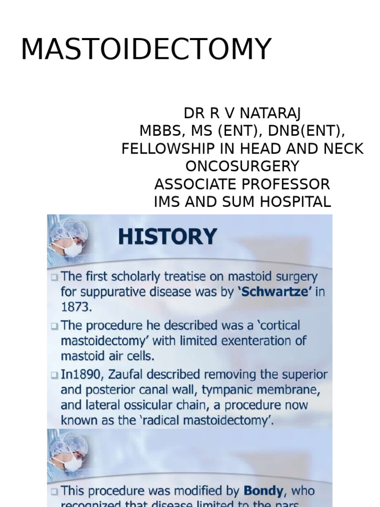 BPPV and Mastoidectomy Overview | PDF