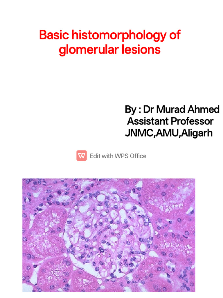 Basic Histopathology of Glomerular Lesions | PDF