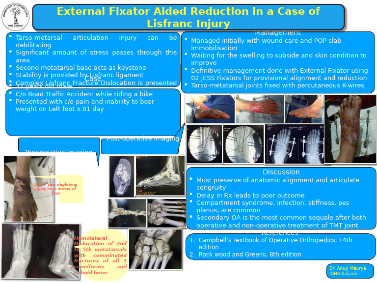 Lisfranc Poster IOACON 2023 | PDF | Surgical Specialties | Diseases And ...