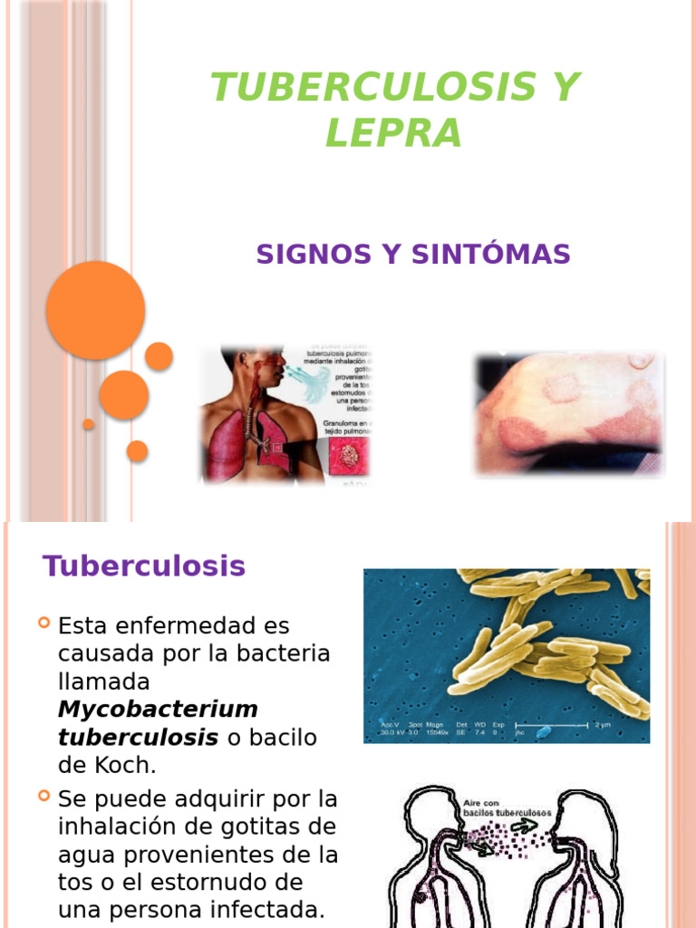 Tuberculosis y Lepra: Síntomas y Tratamiento | PDF | Tuberculosis | Lepra