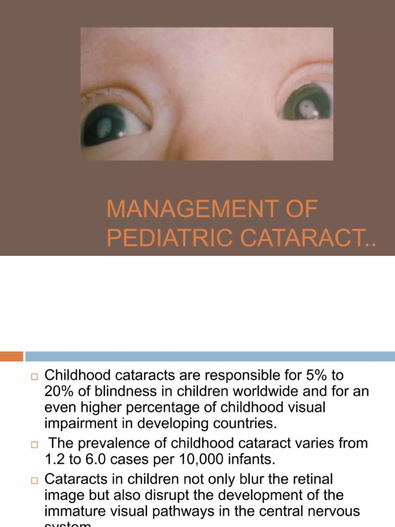 Congenital Cataract Management | PDF