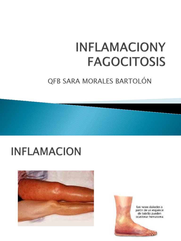 Inflamación y Reparación: Procesos Clave | PDF | Inflamación | Anatomía