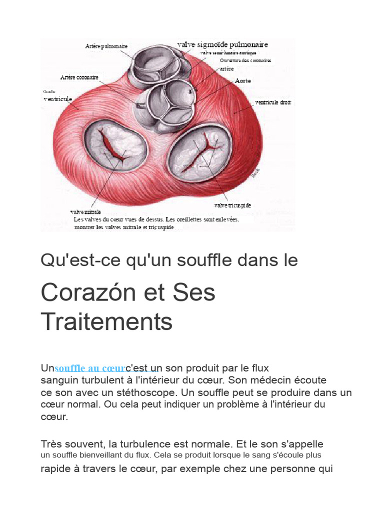 Symptômes et causes du souffle au cœur | PDF | Spécialités médicales ...