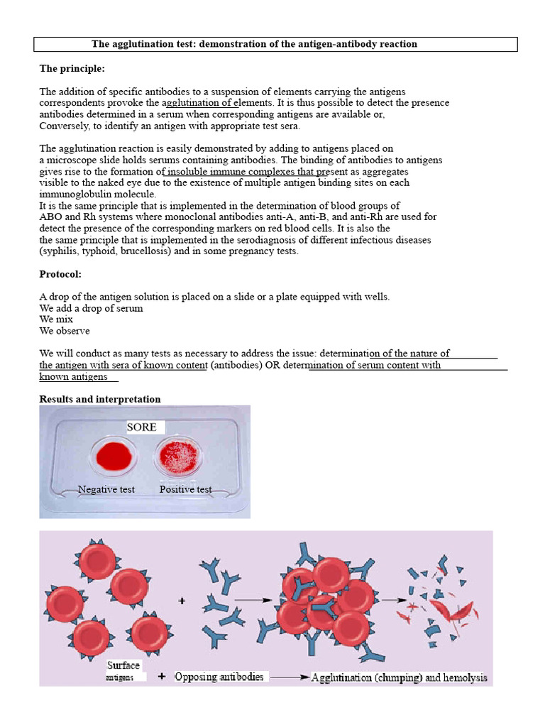 IMM Test of Agglutination | PDF