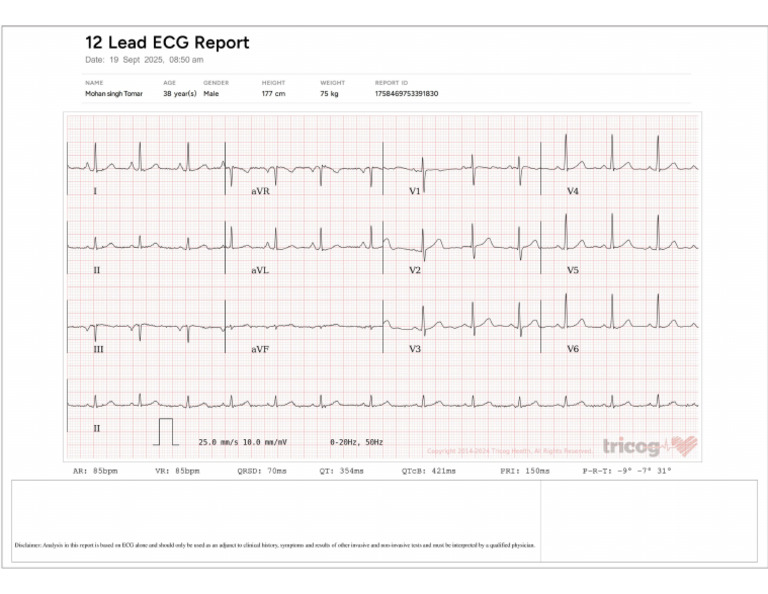 Mohan ECG Final | PDF