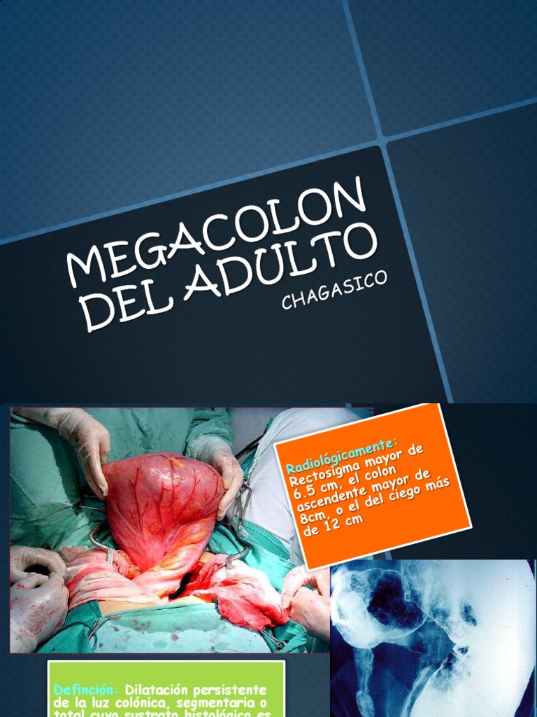 Mega Colon | PDF | Intestino grueso | Recto
