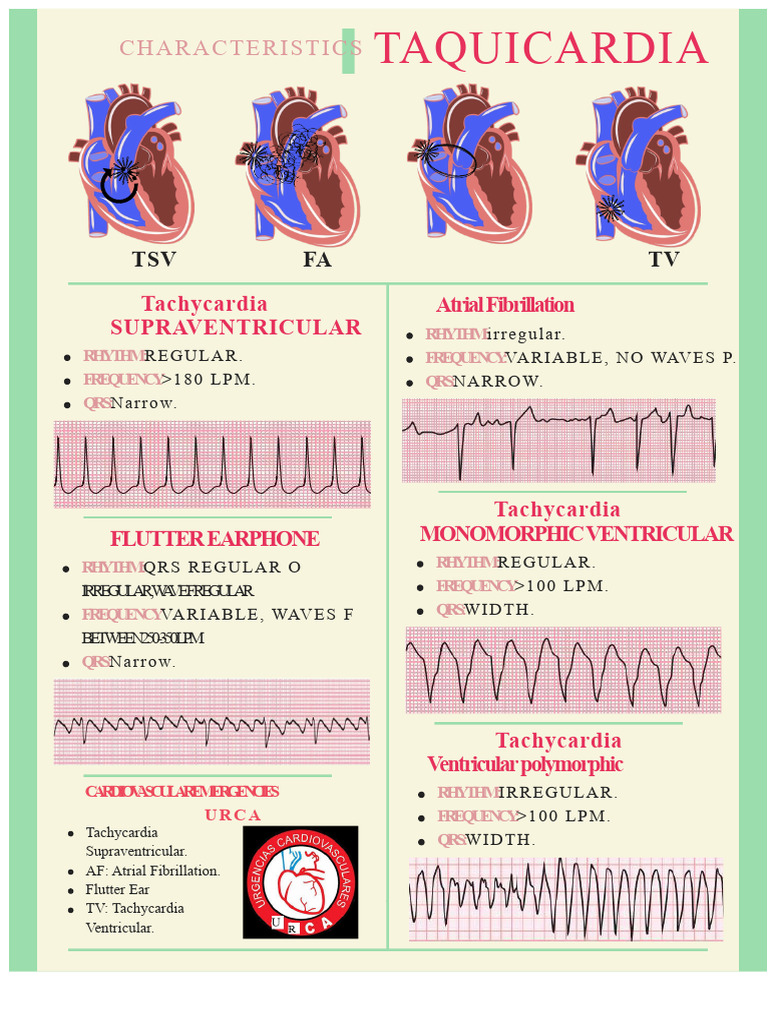5 Characteristics of Tachyarrhythmias | PDF