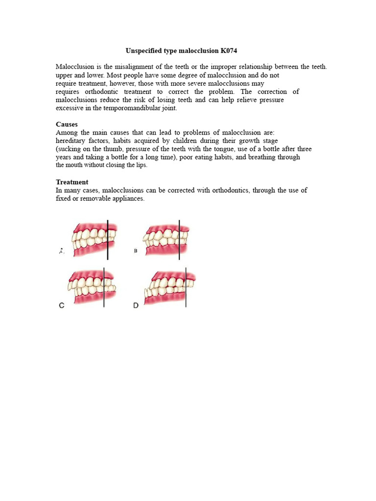 Understanding Unspecified Malocclusion K074 | PDF