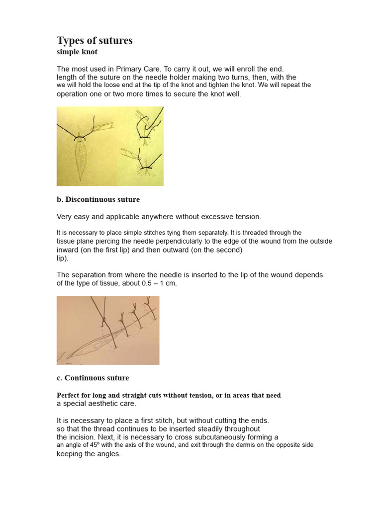 Types of Sutures | PDF | Surgical Suture | Wound
