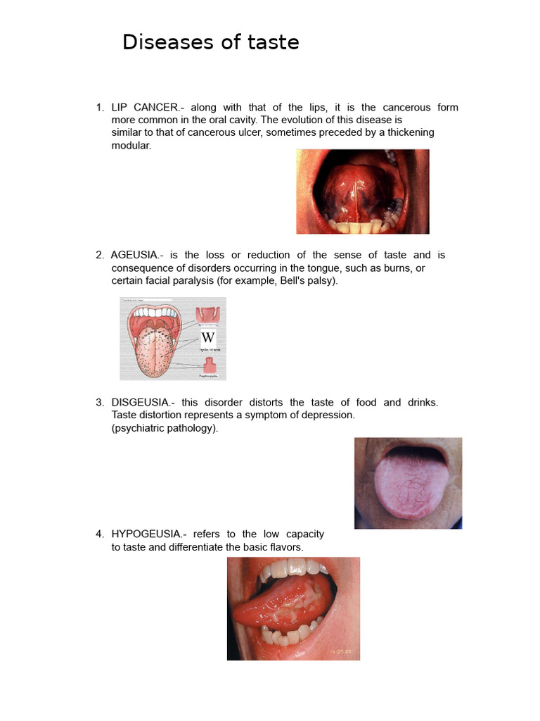 Diseases of Taste | PDF