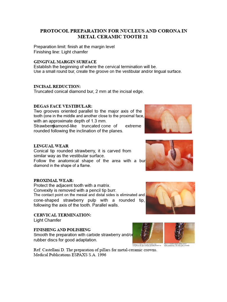 Carved Pillars and Provisional Protocol | PDF | Tooth | Dental Anatomy