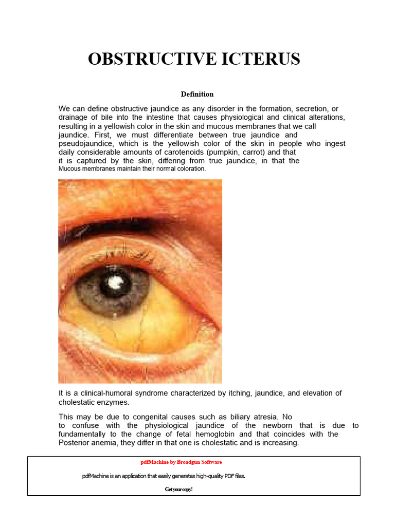 Obstructive Jaundice | PDF | Gallbladder | Liver