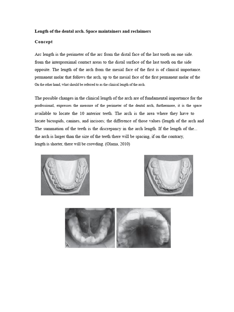 Dental Arch Length and Space Maintainers | PDF | Orthodontics | Tooth