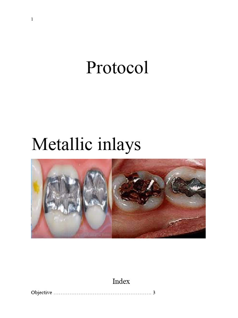 Metal Inlays, Onlays, and Overlays Guide | PDF | Materials | Metals