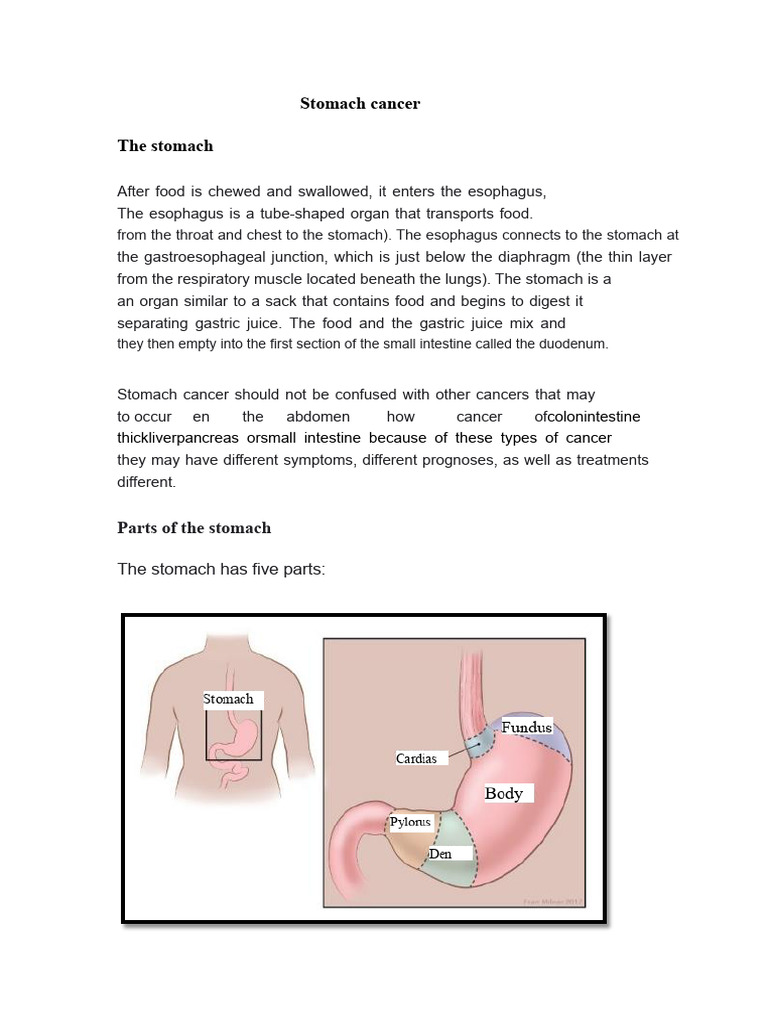 Understanding Stomach Cancer Types | PDF | Stomach | Biopsy