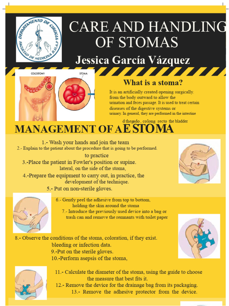Care and Management of Stomas | PDF