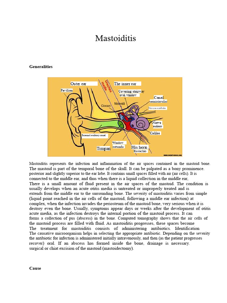 Mastoiditis | PDF | Clinical Medicine | Human Diseases And Disorders