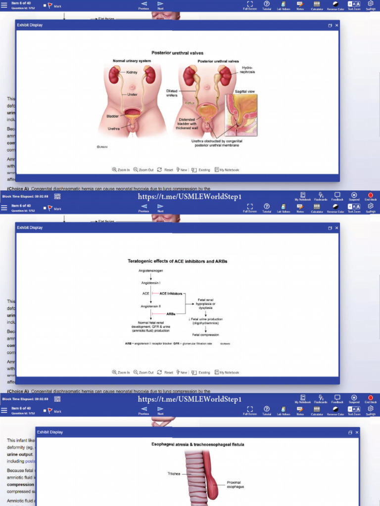 UW 2024 Renal, Urinary Systems & Electrolytes 6 Blocks Compressed-00002 ...
